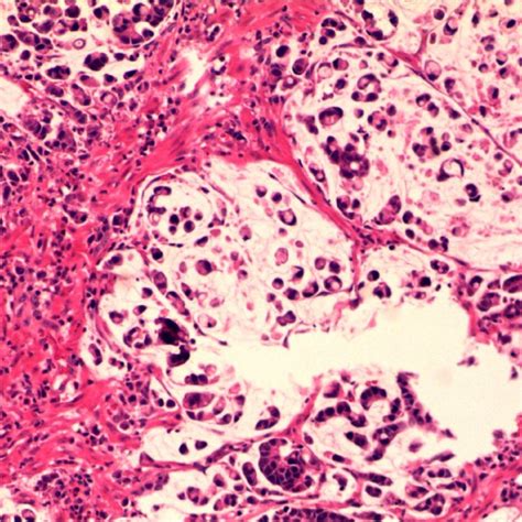 Histological Characteristics Hematoxylin And Eosin Stain Indicated