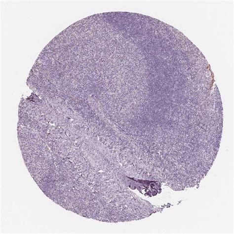 Tissue Expression Of Hopx Staining In Tonsil The Human Protein Atlas
