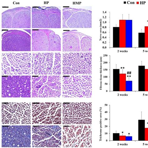 Lfb Cev And Tunel Staining Of The Sciatic Nerves In The Experimental