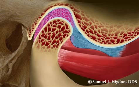 Steps To Simplifying Tmd Diagnosis Spear Education