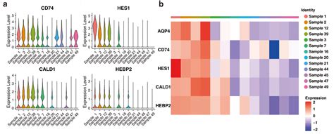 项目文章 单细胞测序揭示胶质瘤相关巨噬细胞极化和肿瘤细胞状态变化 知乎