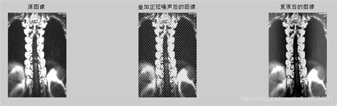 医学图像处理综述医学图像预处理 Csdn博客