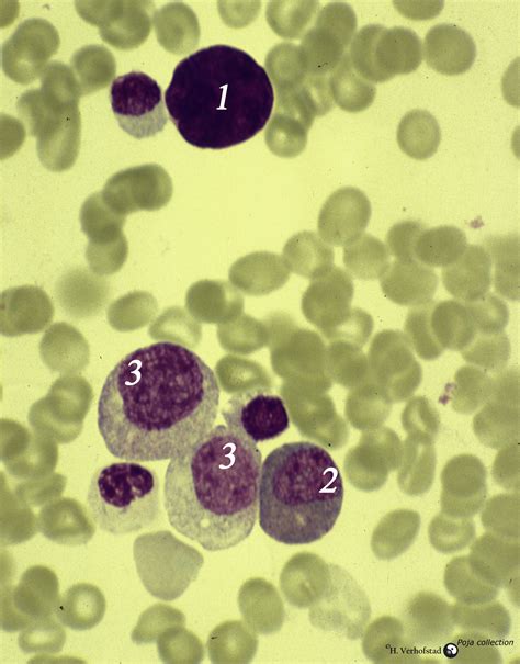 Megakaryocyte In Bone Marrow