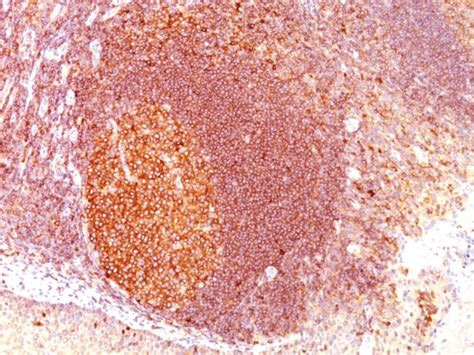 Malt1 Malt Lymphoma Marker Monoclonal Antibody Spm578 10892 Msm1x P0