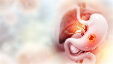 Semaglutide Significantly Improves Steatohepatitis Fibrosis In Phase