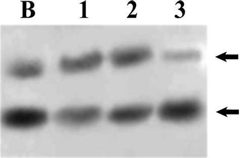 The Gel Electrophoresis From The Control Patient After Microsatellite