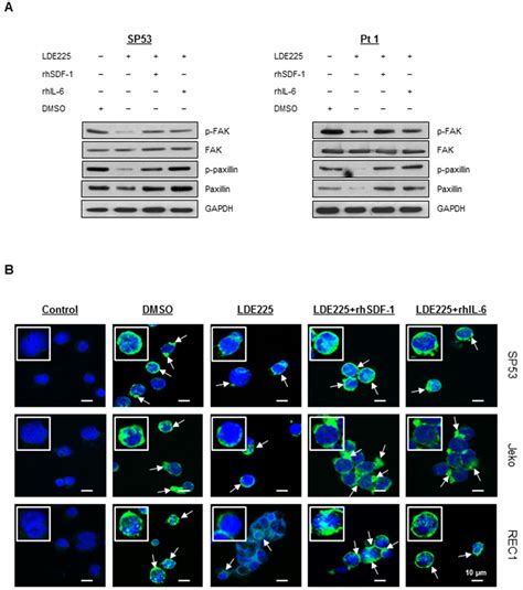 Il 6 And Sdf 1 Reverse The Effect On Actin Polymerization After Lde225