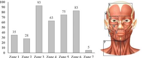 Anatomical Structures Used In Thread Embedding Acupuncture For Facial Download Scientific