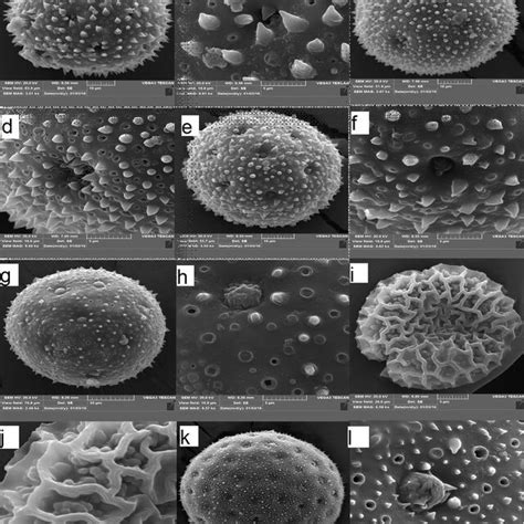 Scanning Electron Microscope Image Sem Of Pollen Grains Of Iranian