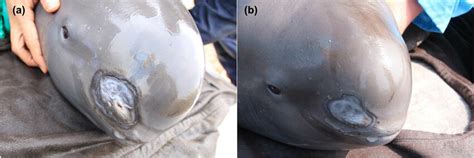 The Typical Appearance Of YFP Before And After Treatment A YFP