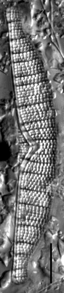 Epithemia Adnata Species Diatoms Of North America