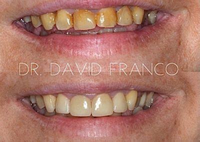 Casos Clínicos Clínica Dental La Fuensanta