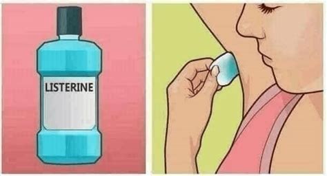 10 Kegunaan Ubat Kumur Antiseptik Yang Masih Ramai Tak Tahu