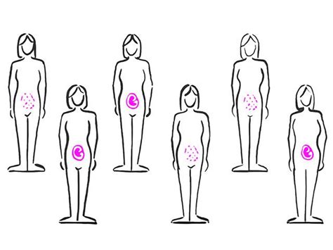 The Universal Cost Of Sex Isthmus Madison Wisconsin