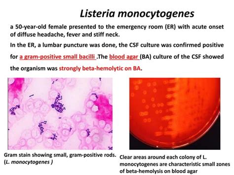 Lab Diagnosis Od Meningitis Pdf