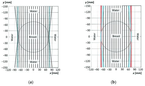 Simulation Of The Refraction Effect Of Ultrasound Beam Rays Along The