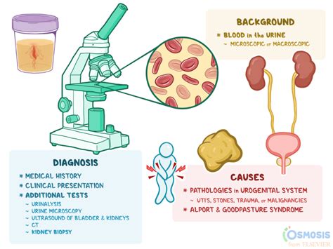 Understanding Hematuria Causes Symptoms And Treatment Ask The