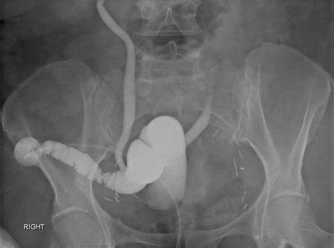 Loopogram Buyxraysonline Loopogram Buyxraysonline