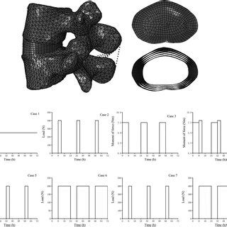 Finite Element Model And Eight Simulation Conditions A Download Scientific Diagram