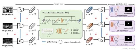 ECCV2022 Personalizing Federated Medical Image Segmentation Via Local