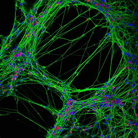 Human Neurons Derived From Neural Stem Cells Nikon Small World