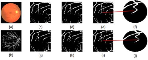 Qualitative Performance Comparison Between The Semi Supervised And