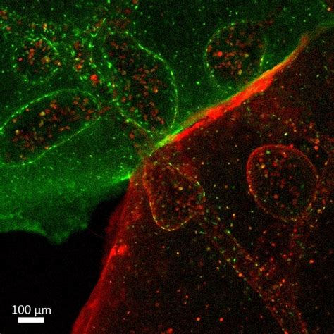 The Evolutionary Prospect On Stem Cell Transplantation Research Communities By Springer Nature