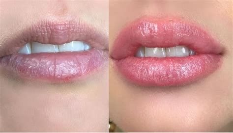 Semi Permanent Makeup Lips Healing Process