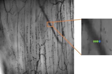 pixel detection and 3d cnn evaluation of a cross section of a vessel