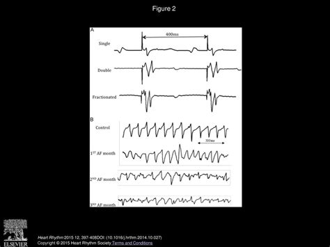 Volume 12 Issue 2 Pages February 2015 Ppt Download