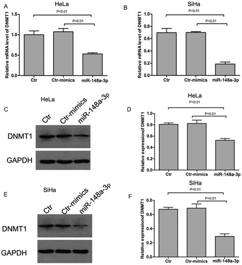 Microrna‑148a‑3p Inhibits The Proliferation Of Cervical Cancer Cells By
