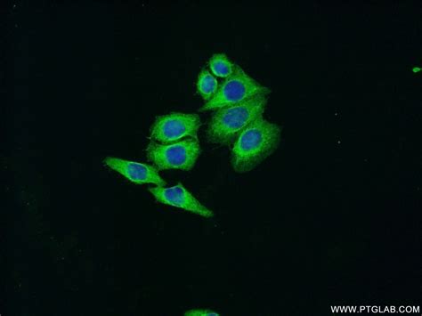 Mtor Antibody 20657 1 Ap Proteintech
