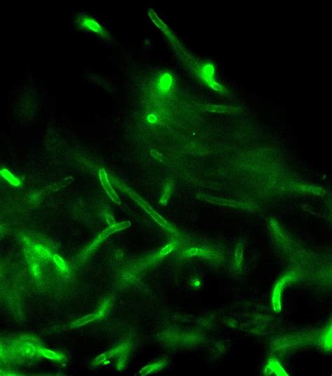 Free Picture Anthracis Direct Fluorescent Antibody Cell Wall Stain