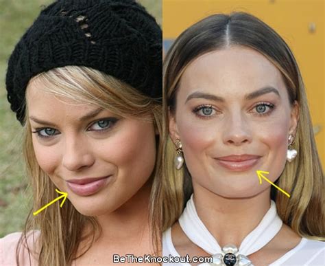 Margot Robbie Plastic Surgery Comparison Photos