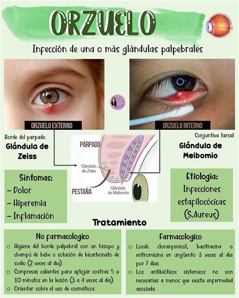 Pin De Andrea Otero En Oftalmología Medicina Humana Medicina