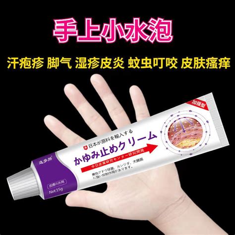 Herpes With Sweat And Long Blisters On The Hands Itchy Blisters On The
