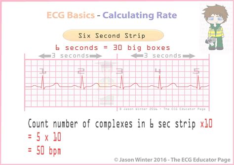 Ekg Basics Rate Calculation Medstudent Ekg Basics Heartrate Rate