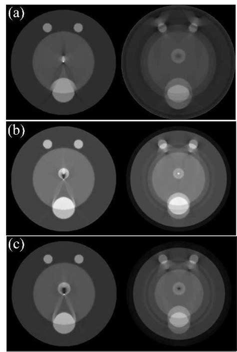 Images Reconstructed From Simulated Thermoacoustic Tomography Download Scientific Diagram