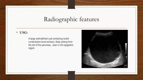 Cystic Masses Of Pancreaspptx