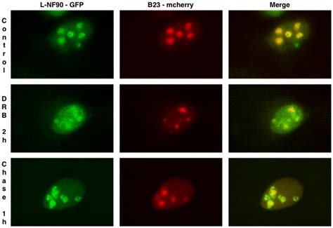 Subcellular Distribution Of Exogenously Expressed L Nf90 Isoforms In