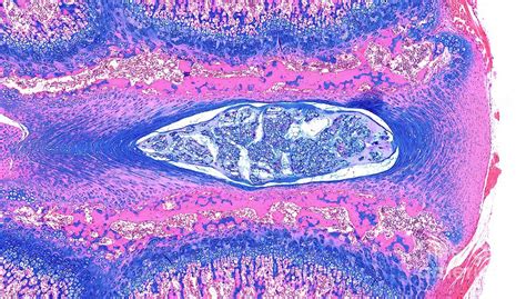 Intervertebral Disc Photograph By Science Photo Library Pixels