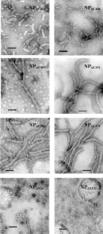 Electron Micrographs Of N And C Terminally Truncated Np Proteins