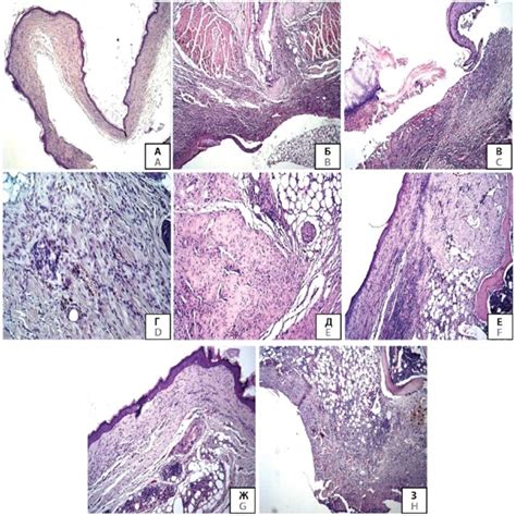 Histological Examination With Hematoxylin And Eosin Staining
