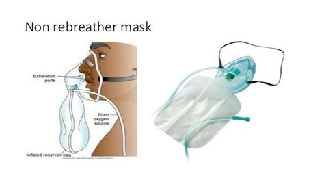 Difference Between Partial Rebreather Mask And Non Rebreather Mask