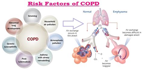 Copd Chronic Obstructive Pulmonary Disease Pathophysi