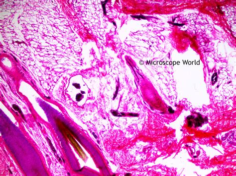 Microscope World Blog Scalp With Hair Under The Microscope