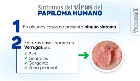Precios Y Tratamientos Virus Del Papiloma Humano En Hombres