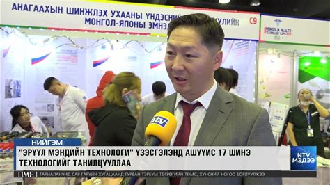 Өвдөгний үе шилжүүлэн суулгах мэс заслыг роботын тусламжтай Монголд анх