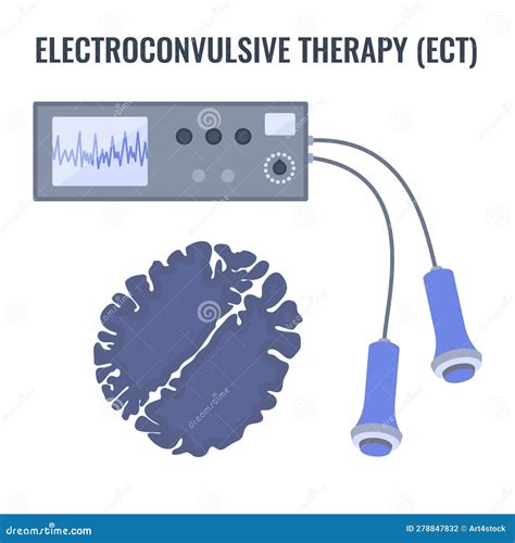 Ect Electroconvulsive Therapy For Severe Depression Treatment Cartoon