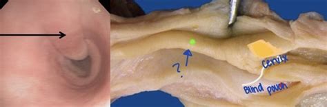 Canine Estrous Cycle Flashcards Quizlet